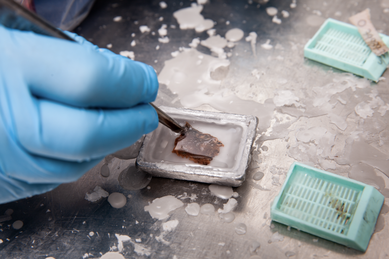 Why Choose PRS For Your Immunohistochemistry Staining?